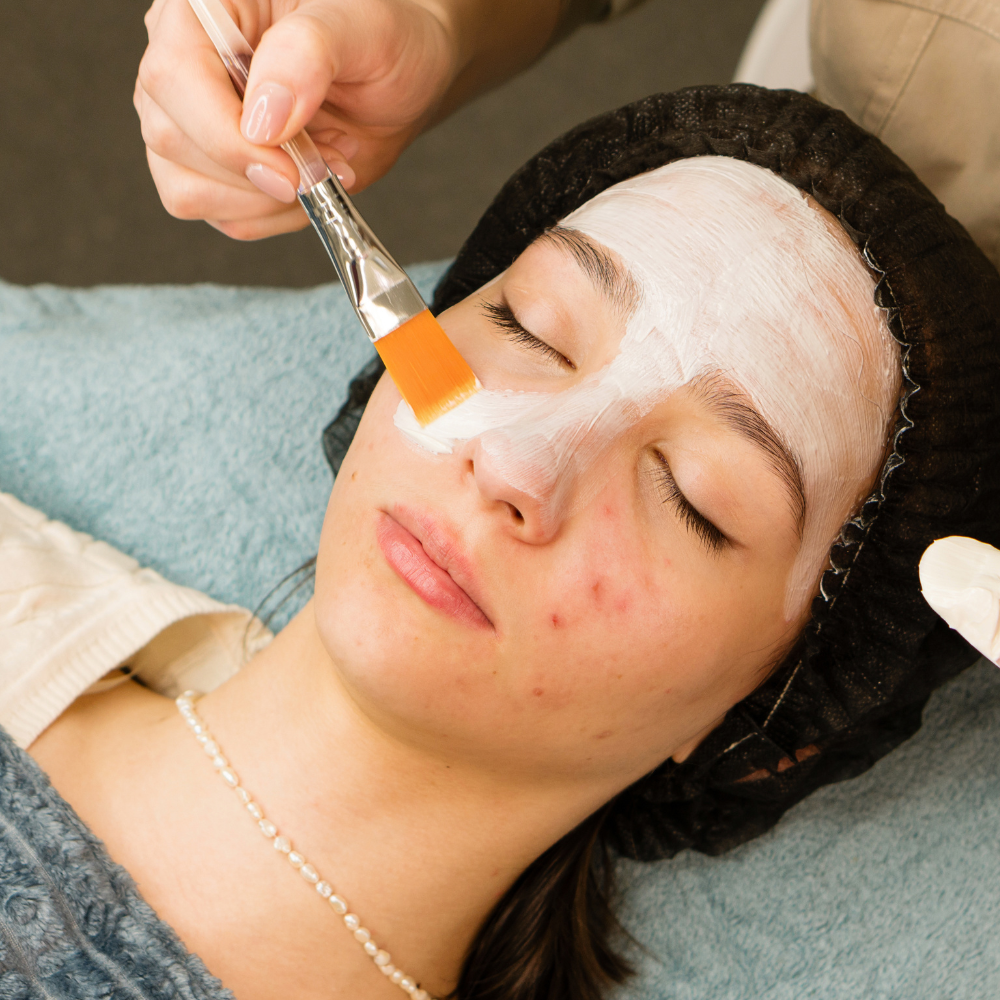 Control Cosmetológico del Acné (3 sesiones) — Dermatología Estoril